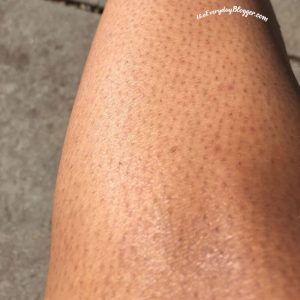 How To Get Rid Of Strawberry Legs In 5 Easy Steps - The Everyday Blogger